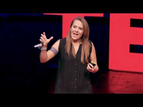 The Third Thumb: The Prosthetic 3D Printed Hand Augmentation Device ...
