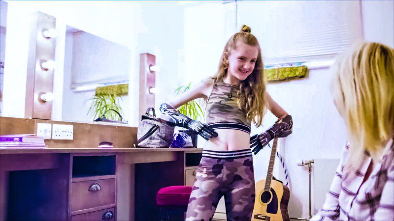 Engineering a Bionic Arm That Grows with the Wearer [Video] – TechAcute