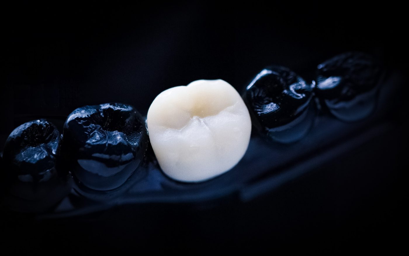 How 3D Printing Teeth Is Transforming the Dental Industry – TechAcute